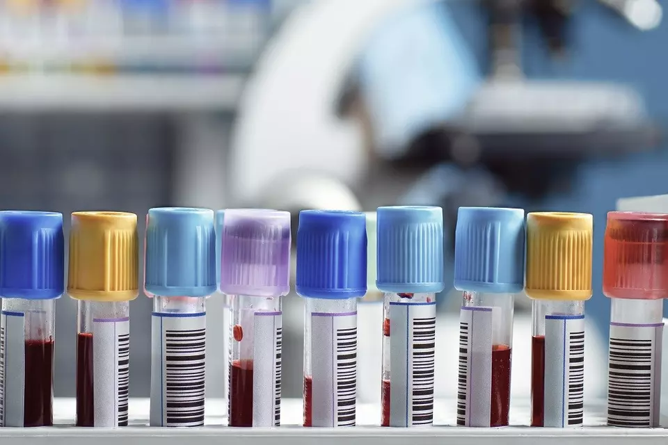 New blood test shows promise for detecting Parkinson’s | Parkinson's UK