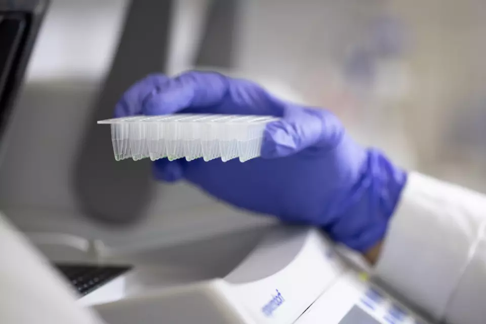 New lab test could help improve earlier diagnosis of Parkinson’s ...